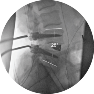 ProAxis Brochure | Mizuho OSI